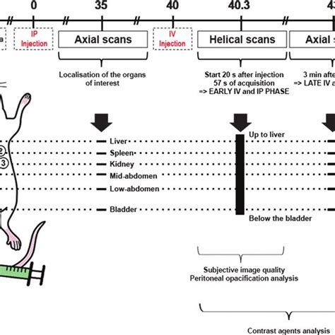 Abdominopelvic Spectral Photon Counting Ct Images And Contrast Material Download Scientific