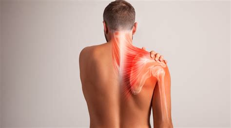 Winged Scapula Anatomy Causes Treatment The Care News