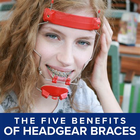 Headgear Braces Chamblee Orthodontics Atlanta Ga