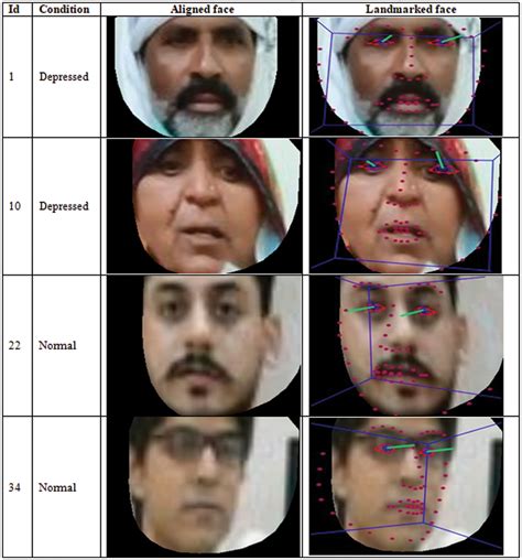 An Automated And Real Time Approach Of Depression Detection From Facial Micro Expressions