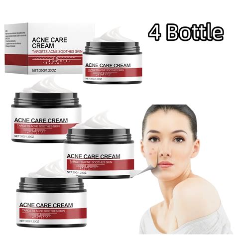 Acne Face Wash Pimple Cream For Face Oil Control Pimple Remover Cream Get Rid Of Pimples Fast