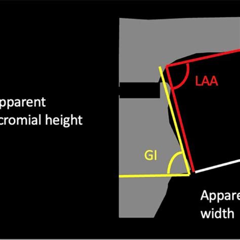 Illustration Of The Effect Of Glenoid Morphological Variation On Download Scientific Diagram