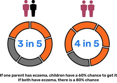 Essential Eczema Knowledge Article