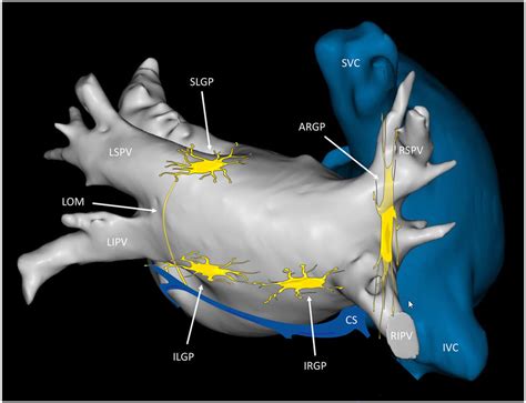 Anatomical Localization Of The Major Left Atrial Ganglionated Plexi