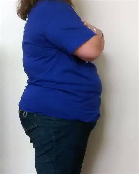 Weight Loss Patient E Atlantis Medical Wellness And Weight Loss