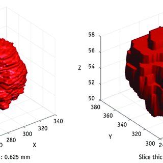 Effect Of CT Slice Thickness On Tumor Visualization Thick Section CT Download Scientific