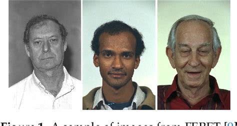 Figure From Evaluation Of Automatic Facial Wrinkle Detection Algorithms Semantic Scholar