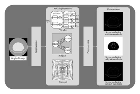 Proposed Segmentation System For Medical Images Download Scientific