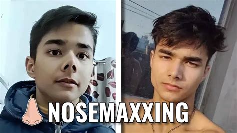 How To Make Your NOSE Perfect Looksmaxxing YouTube