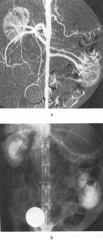 The Chemical Structure Of Ioxilan Iohexol And Diatrizoate Download Scientific Diagram