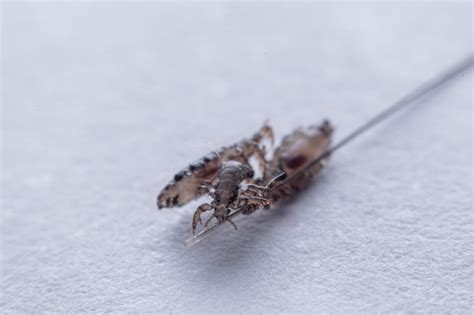 Premium Photo Macro Close Up Pediculus Humanus Capitis Head Louse
