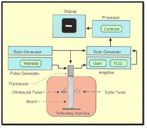 Ultrasound Imaging Systems Glowriters