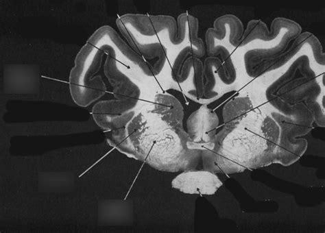 Diagram Of Basal Ganglia Scan Labelling Quizlet