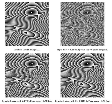 Deep Learning Network For Speckle De Noising In Severe Conditions