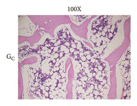 A B Enlarged And Massive Fat Cells And Sparser Trabecular Bone Were Download Scientific
