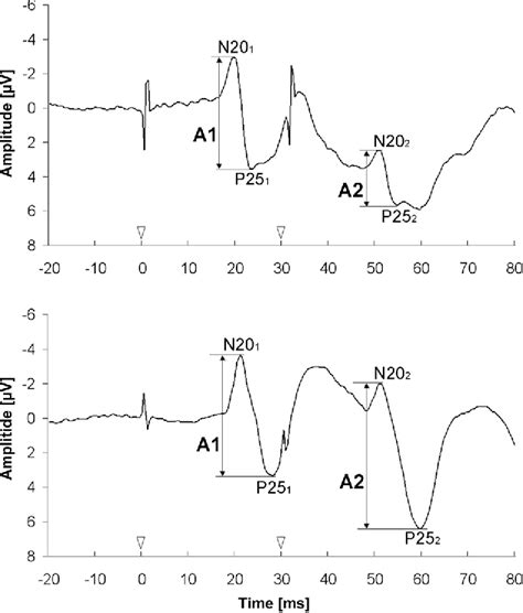 Figure 1 From Increased Excitability Of Somatosensory Cortex In Aged Humans Is Associated With