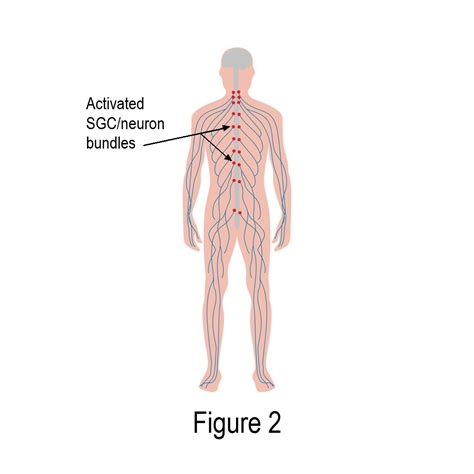 Is Fibro An Autoimmune Disease American Fibromyalgia Syndrome