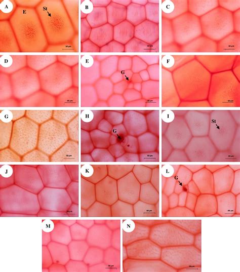 Figure 3 From Comparative Leaf Epidermis Study In Habenaria Spp