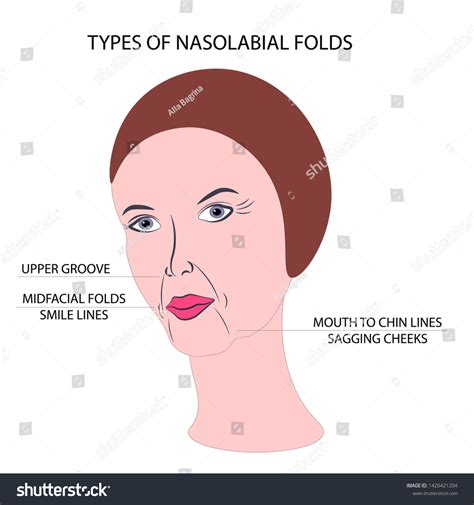 Woman Face Demonstrating Types Nasolabial Folds Vector De Stock Libre
