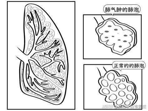 了解肺功能，守护呼吸健康——肺功能科普第一讲澎湃号·湃客澎湃新闻 The Paper