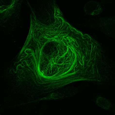 Human Lung Cell Infected With Coronavirus Nikon Small World