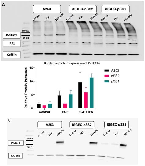 Regulation Of Stat1 And Stat4 Expression By Growth Factor And