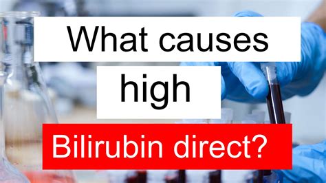 What Causes High Bilirubin Direct And Low Creatinine