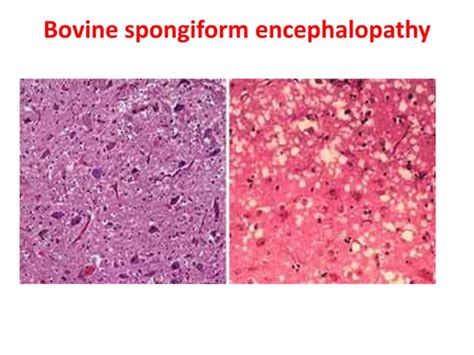 Pathology Transparency Slides Histo Pathologypptx