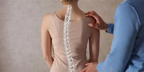 Scoliosis Treatment Schroth Method Chpc