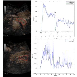 Analysis And Perfusion Curves The Figure Displays Contrast Images From Download Scientific