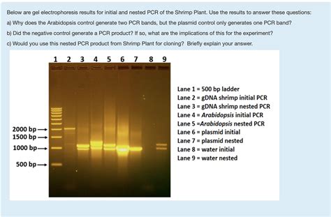 Answered Below Are Gel Electrophoresis Results… Bartleby