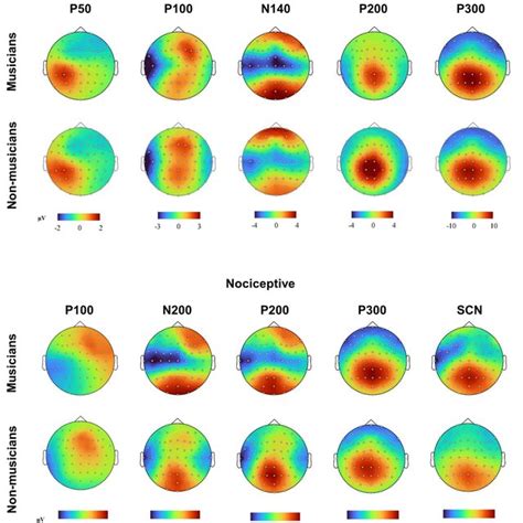 Scalp Topographies To Non Nociceptive And Nociceptive Stimuli Top Download Scientific Diagram
