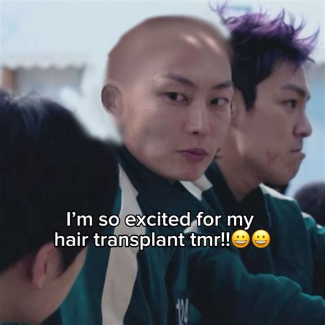 Best 12 13 Different Types Of Chins A Comprehensive Guide Artofit