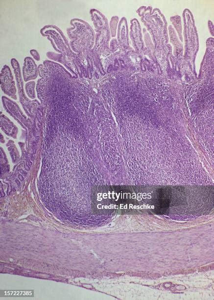 Lymph Node 10x Shows Cortex Medulla Lymph Nodules Capsule A