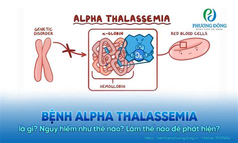 Bệnh Alpha Thalassemia Là Gì Nguy Hiểm Như Thế Nào