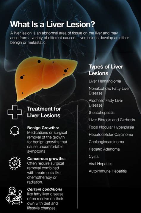 Liver Lesions Symptoms Causes Treatment And More Dlyeim