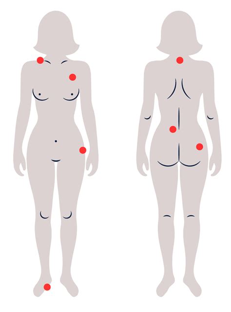 Trigger Point Release Areas Orthopedic Spine Therapy