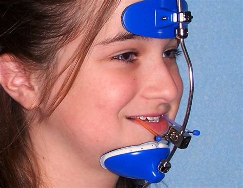Headgear Braces Uses Risks And Benefits