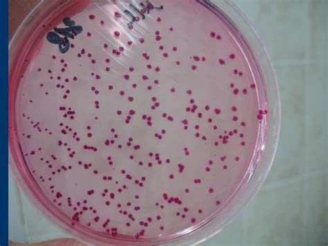 Семейство Еnterobacteriaceae - презентация онлайн