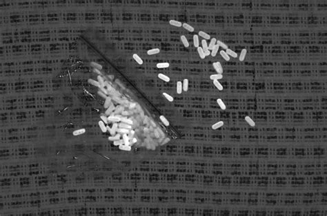 Ciprofloxacin And Exercise Bethpage Consultants