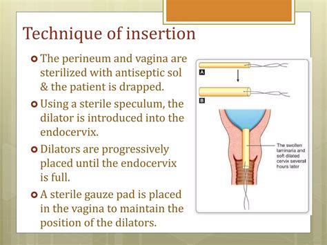 Induction Of Labour PPTX Pregnancy Reproductive Health