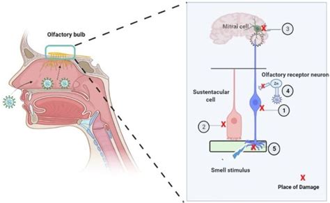 Siddharth Padhiyar Pt On Linkedin Cranial Nerve 1 Clinical Relevance Anosmia Anosmia Is