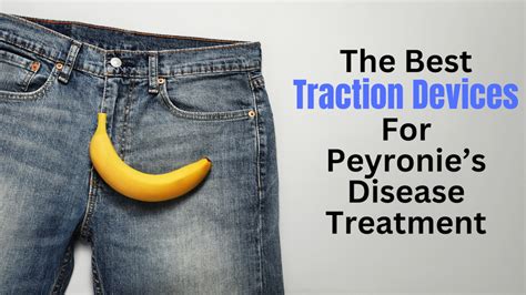 Best Traction Devices For Peyronies Disease Treatment