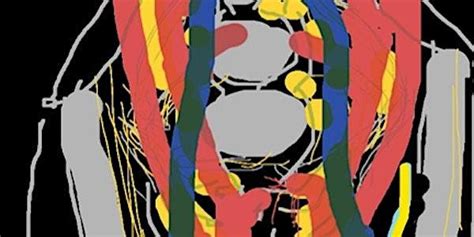 Laparoscopic Female Surgical Pelvic Anatomy Cadaveric Course Keele