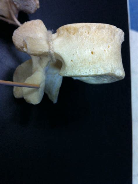 Inferior Articular Facet