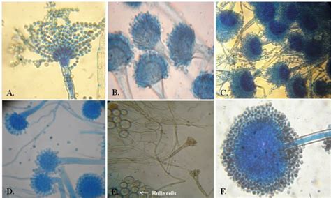 Microscopic Characters Of Aspergillus Isolates A A Flavus B A