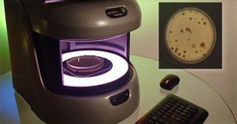 Protocol 3 Automatic Colony Counting And Zone Measurement From Synbiosis