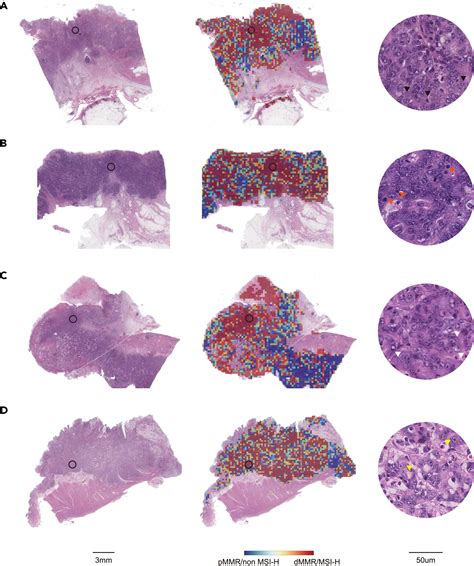 An Interpretable Deep Learning Model For Identifying The Morphological