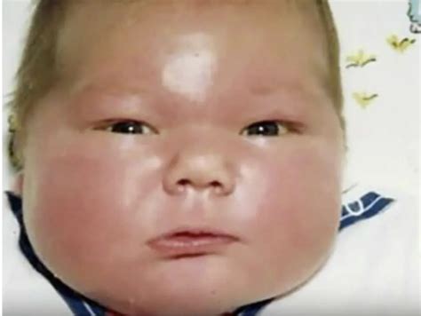 Once A 16 Pound Newborn In 1983 This Adult Is Still Recognized For His