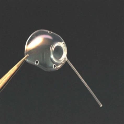 Surgical Procedures For Glaucoma Trabeculectomy Shunt